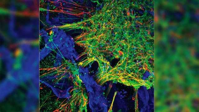 Functioning 3D Human Neural Networks Developed From Stem Cells ...