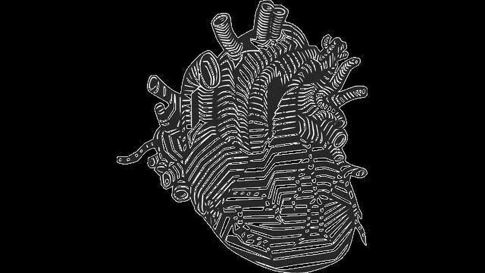 Personalized Implants Designed to Improve Organ Transplant Success ...