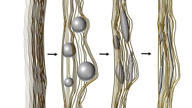 Skeletal Imitation Reveals Bone Mineralization in Fine Detail ...