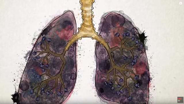 How Do Cigarettes Affect the Body? | Technology Networks