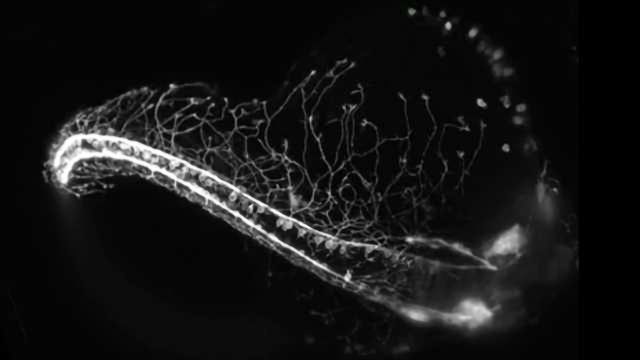 Stunning Sensory Neuron Development in Zebrafish | Technology Networks