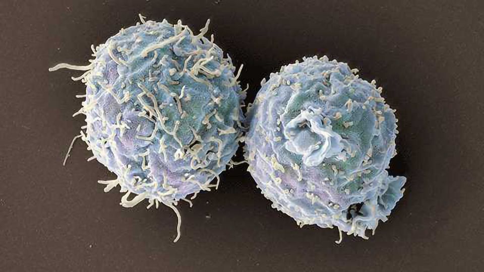 Engineered T Cells Promote Long-term Organ Transplant Acceptance ...