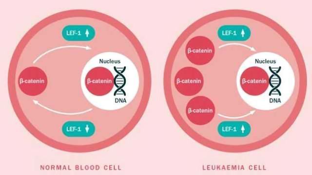 Mechanism for Leukemia Cell Growth Discovered Prompting New Treatment ...