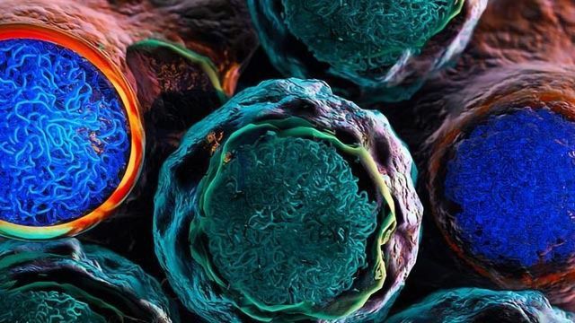 Finding Second Hits to Knock Out Leukemia | Technology Networks