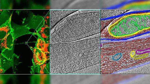 Incredible Tunneling Nanotubes Connect Neurons | Technology Networks