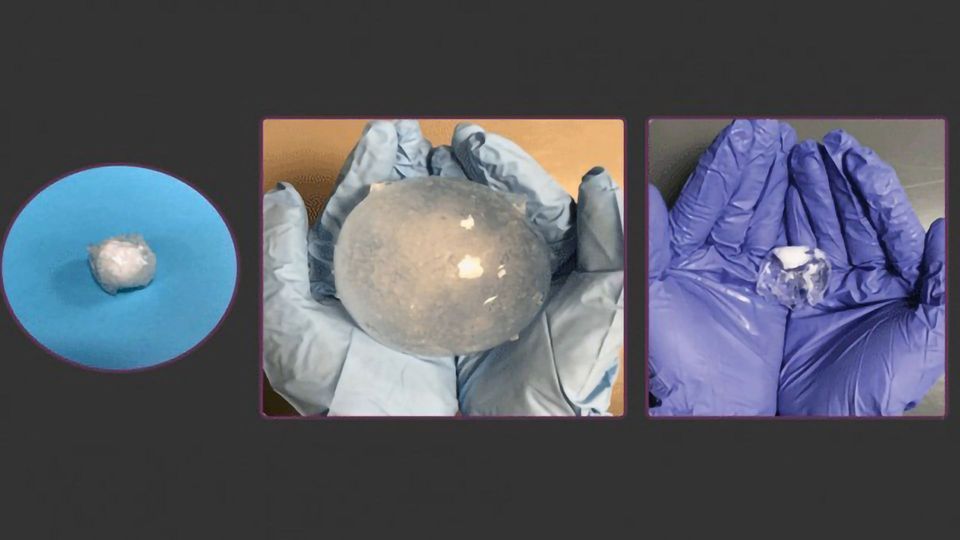 Ingestible Hydrogel Device Opens World of Possibilities | Technology ...