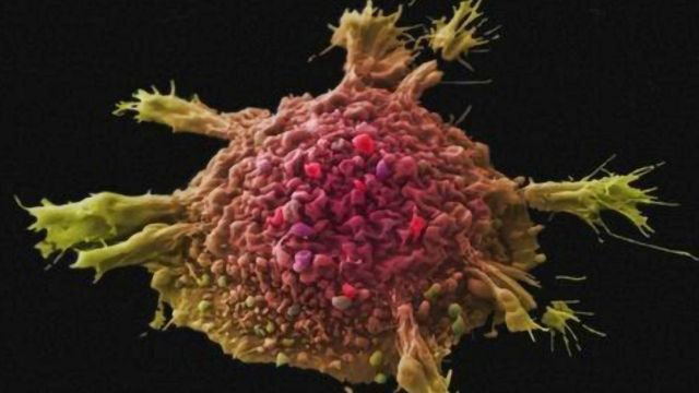 The Spectacular World of Cancer Cell Imaging [Flipbook] | Technology ...