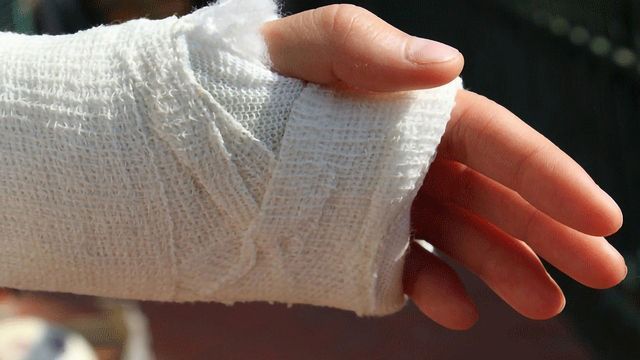 How Fibrosis Develops in Butterfly Syndrome | Technology Networks