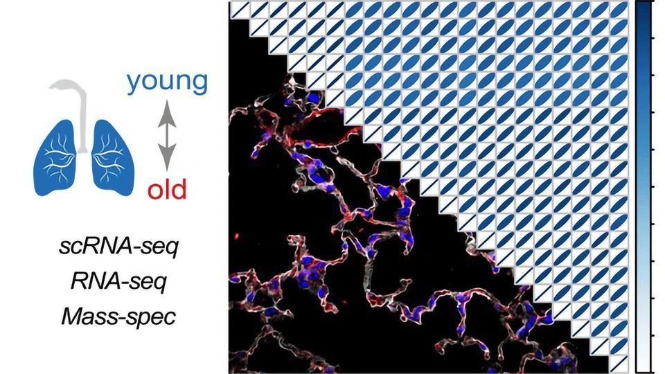 Cell Atlas of the Aging Lung | Technology Networks