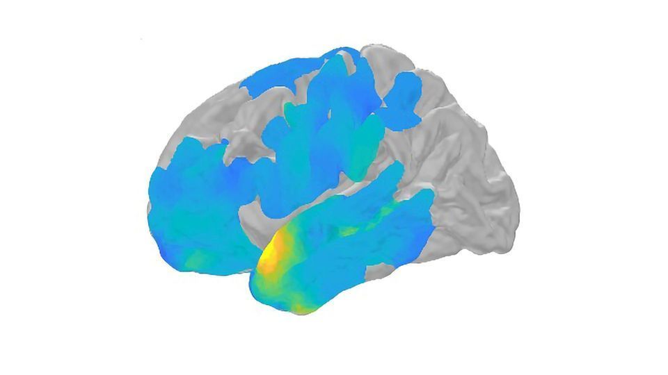 A Ripple Before Remembering | Technology Networks