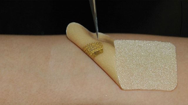 Wearable Sensor Mimics Skin and Monitors Healing Wounds | Technology ...