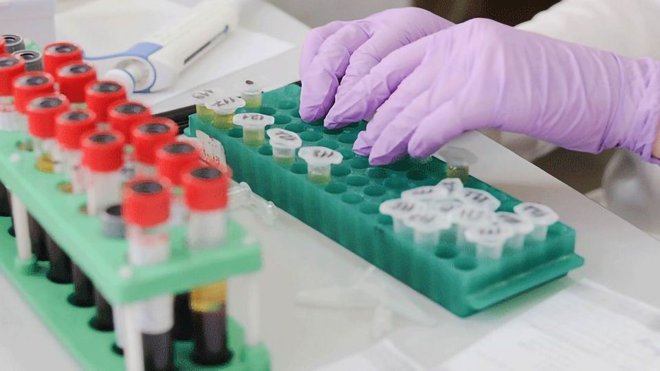 Blood Test Indicates Alzheimer's Drug Effect on Nerve Cell Loss ...