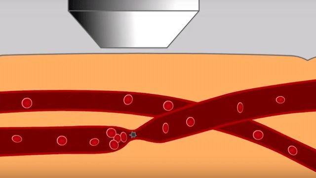 Specialized Microscope Scans and Closes Single Blood Vessels ...