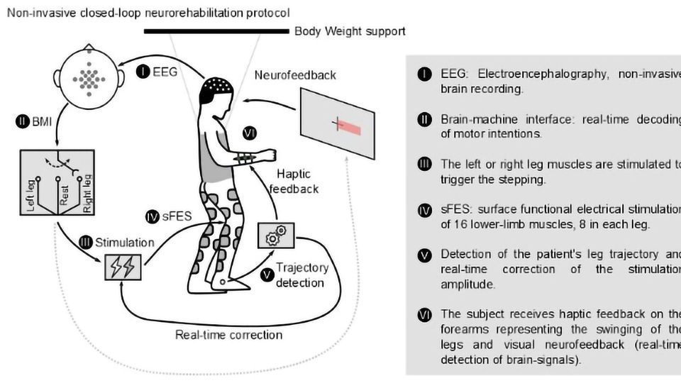Brain-Controlled, Non-Invasive Muscle Stimulation Allows Chronic ...
