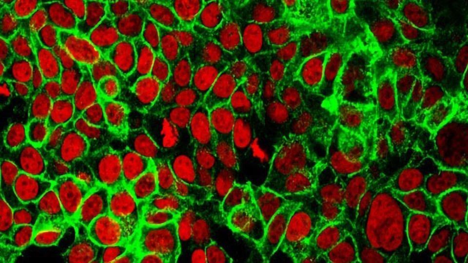 Strawberry Tree Honey Inhibits Colon Cancer Cell Proliferation ...