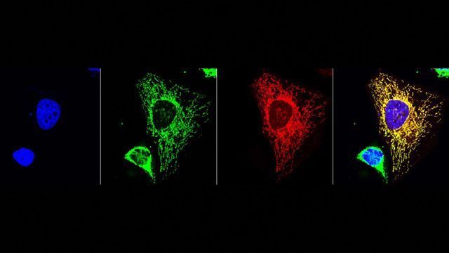 Hundreds of Microproteins Detected in the Human Heart | Technology Networks