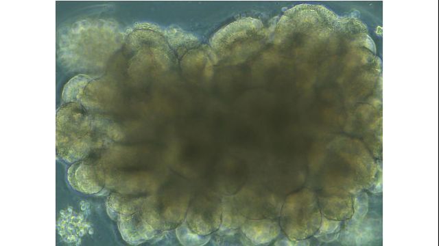 NIAID Scientists Develop “Mini-brain” Model of Human Prion Disease ...