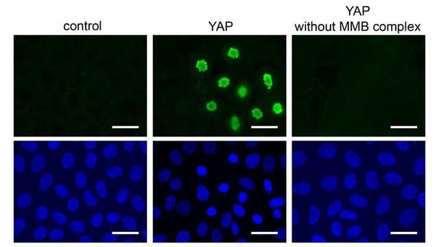 Targeting High-speed Cell Division in Cancer Cells | Technology Networks