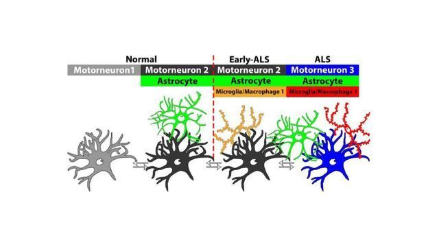 Unique Neuronal Populations Could Be Biomarkers for ALS | Technology ...
