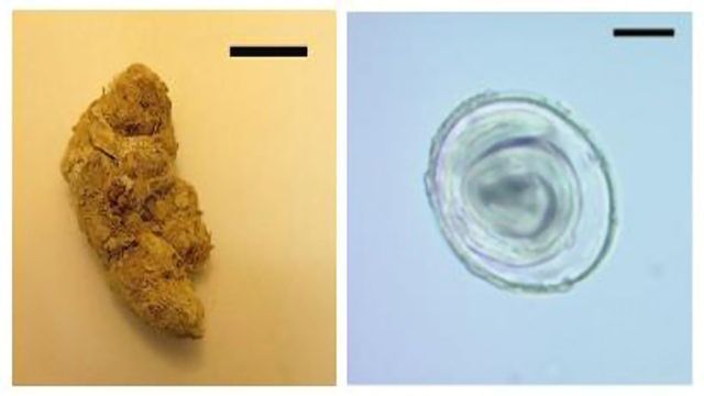 The Oldest Parasite DNA Ever Recorded Has Been Found in Prehistoric ...