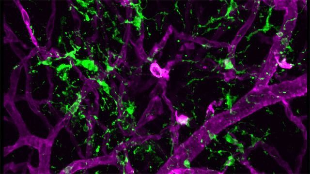 Immune Cells Rewire and Repair the Brain While We Sleep | Technology ...