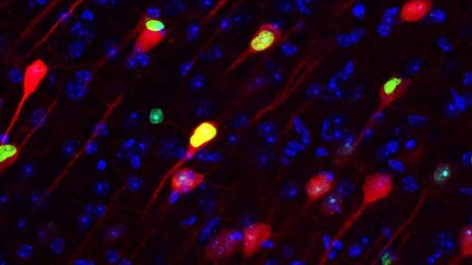 Engrams Emerging as the Basic Unit of Memory | Technology Networks