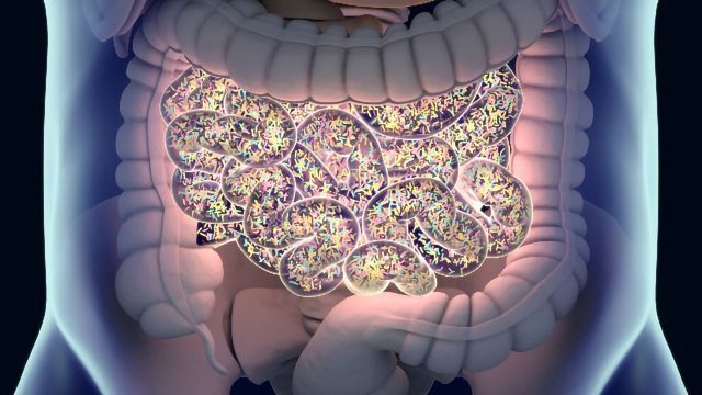 "Unhealthy" Gut Microbiome Linked to PCOS and Obesity in Teens ...