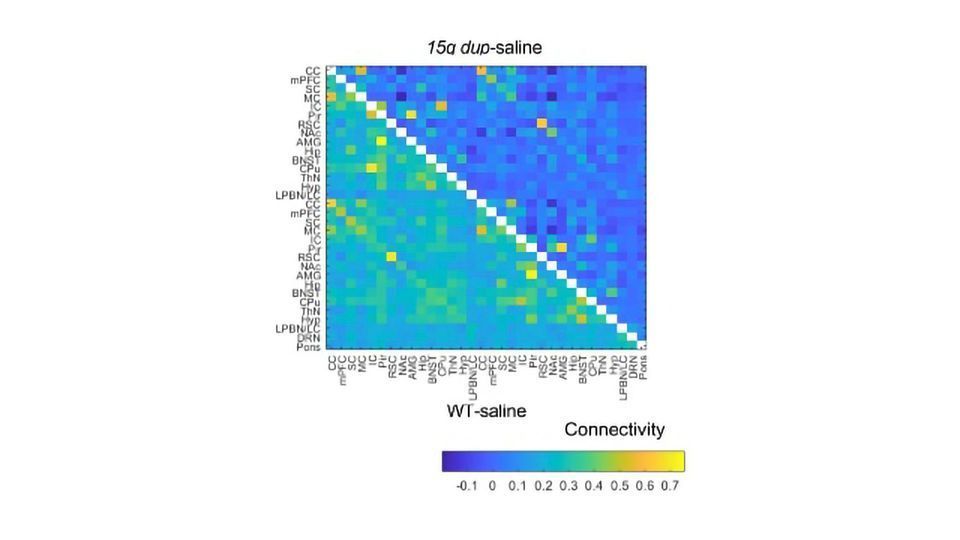 Conscious fMRI Shows Brain Connectivity Change in Autism Mouse Model ...