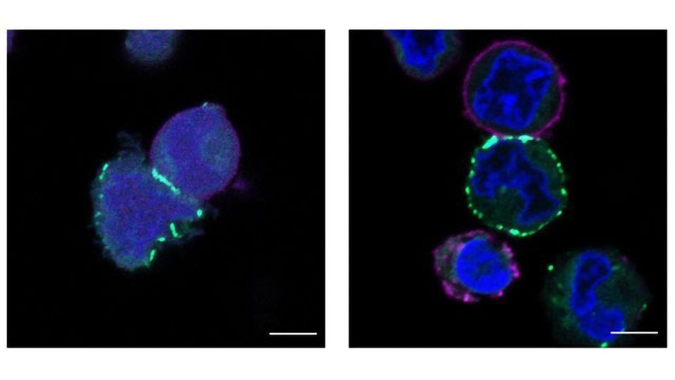 Map of Proteins and Their Nearest Neighbors Illuminates Path to Cancer ...