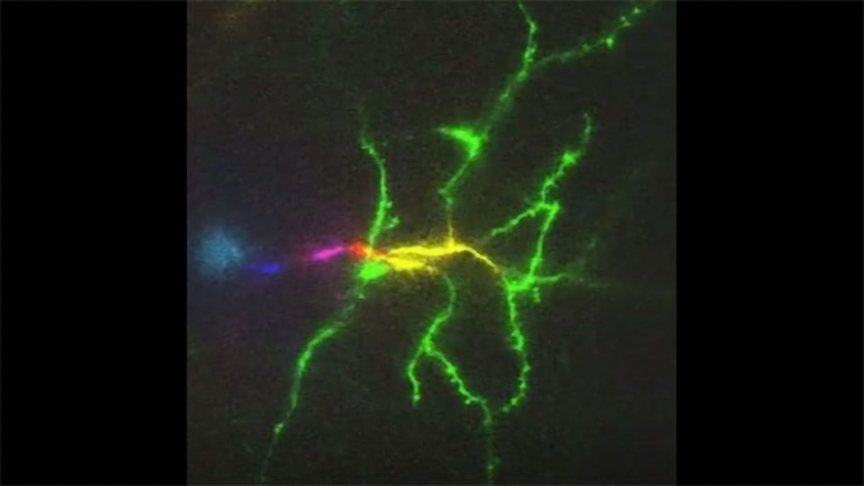 Microscope Can Image a Mouse Brain 1,000 Times a Second | Technology ...