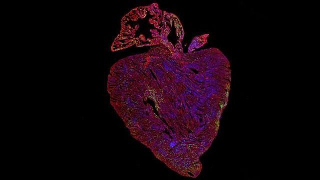 Activating Key Cancer Gene Could Provide First Curative Treatment for ...