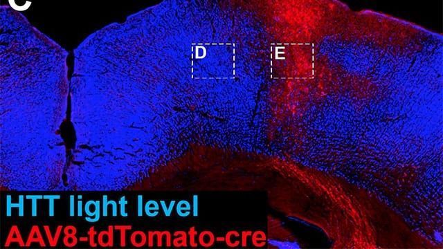 Adult Brain Repair Involves Going Back to the Beginning | Technology ...