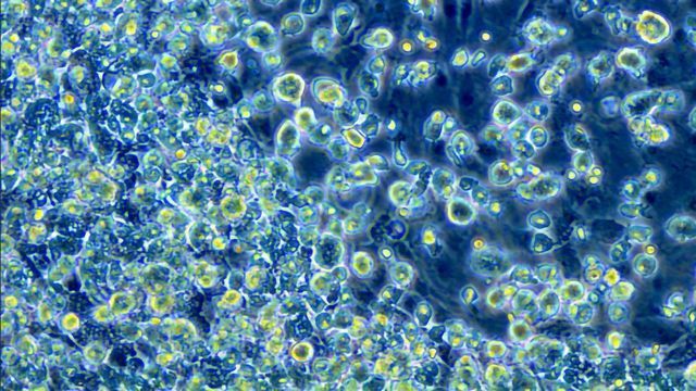 Computational Techniques Separates Out Single Cell Data From Multiple
