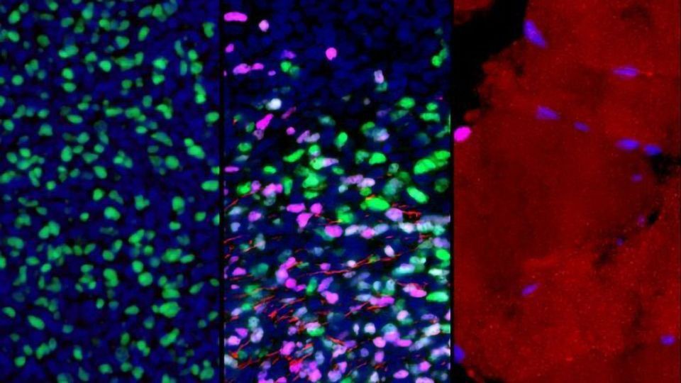 First Roadmap of Human Skeletal Muscle Development Created | Technology ...