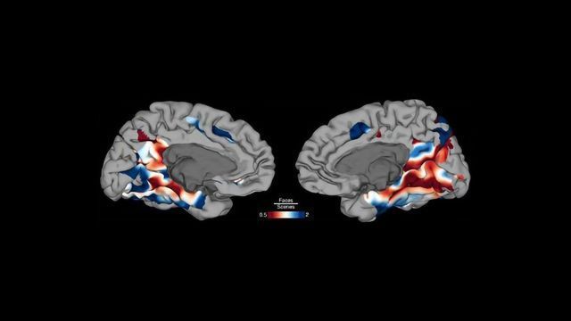 Identifying the Brain Regions Linked to Facial Recognition | Technology ...