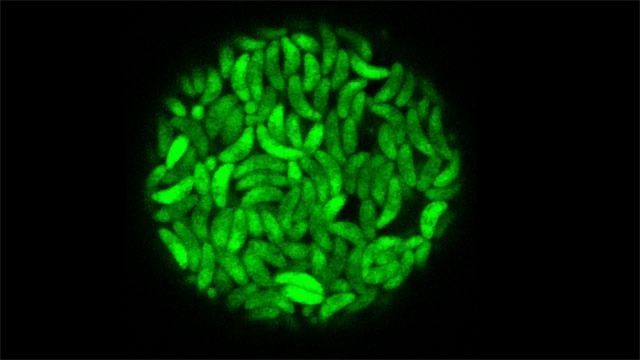 How Toxoplasma Glides So Swiftly Through Mammalian Tissues | Technology ...