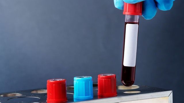 Novel Biomarker Technology for Cancer Diagnostics Developed ...