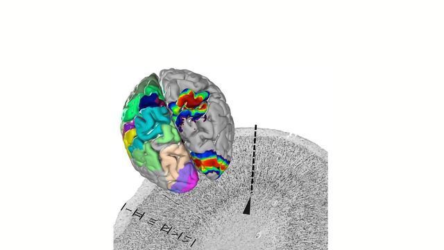 A "Google Earth" for the Brain Has Been Published | Technology Networks