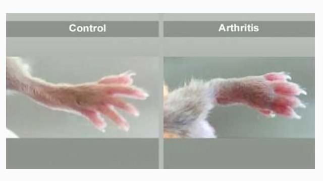 New Molecule Suppresses Inflammatory Process in Mice With Genetically ...