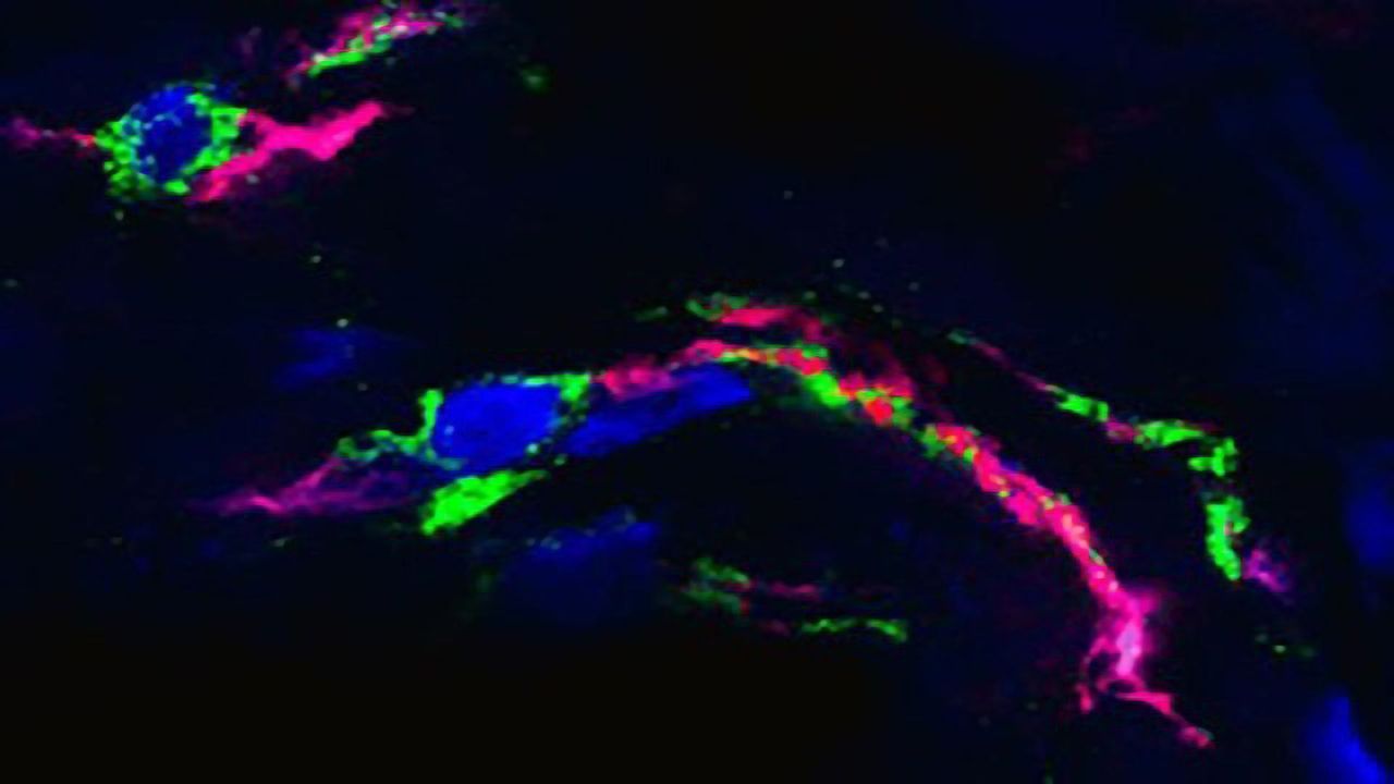 DNA “Nets” Detected in Lungs of COVID-19 Patients | Technology Networks