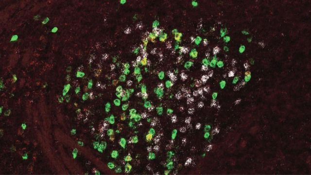 How Does the Brain Process Fear? | Technology Networks