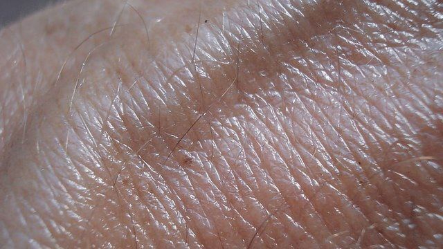 T-Rays Offer Useful Tool for Characterizing Skin Conditions ...