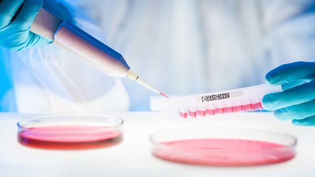 UTI Self-Test More Accurate With Digital Bacterial Culturing ...