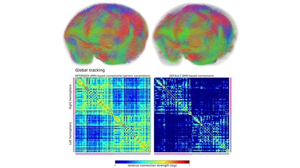 AI Accelerates Brain Connection Mapping Project | Technology Networks