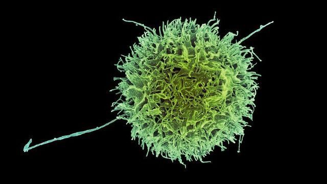 "Invisible" Stem Cells Evade Natural Killer Cells Using Immune Off ...