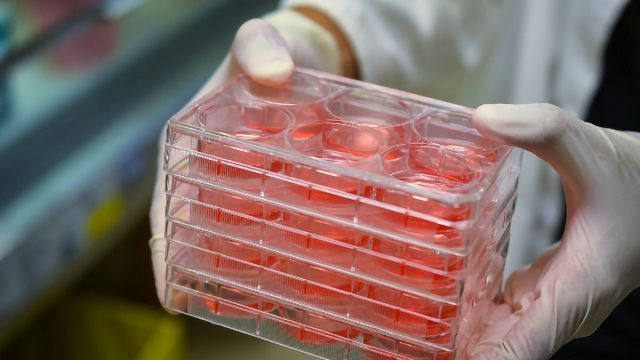 Cell Culture Contamination: Mycoplasma and Problematic Cell Lines ...