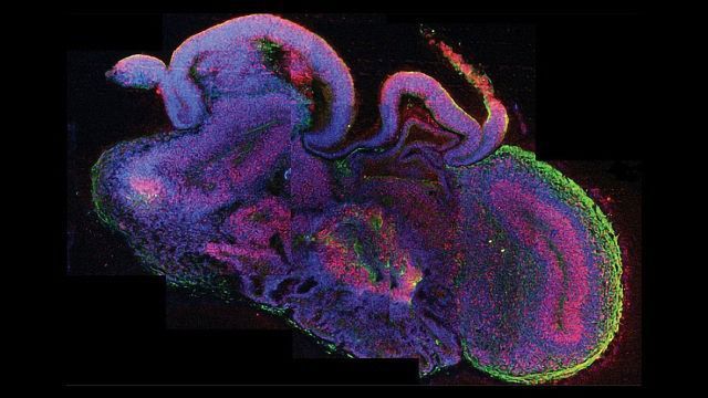 Lab-Grown Brain Organoids Mature Like Infant Brains | Technology Networks