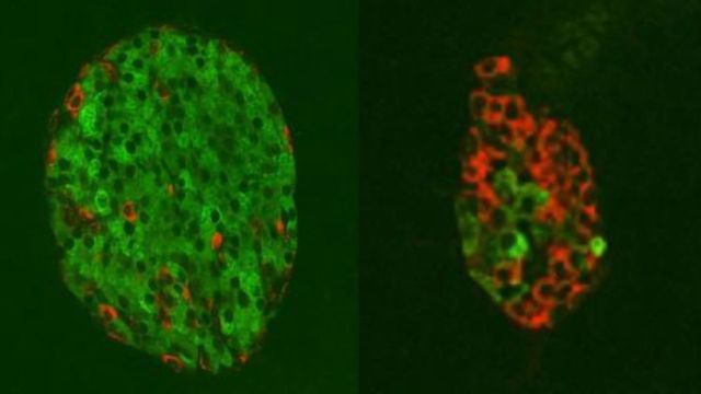 Swapping Alpha Cells for Beta Cells To Treat Diabetes | Technology Networks