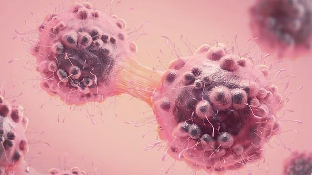Protein Manipulates Metabolism To Block Cancer Cell Death | Technology ...