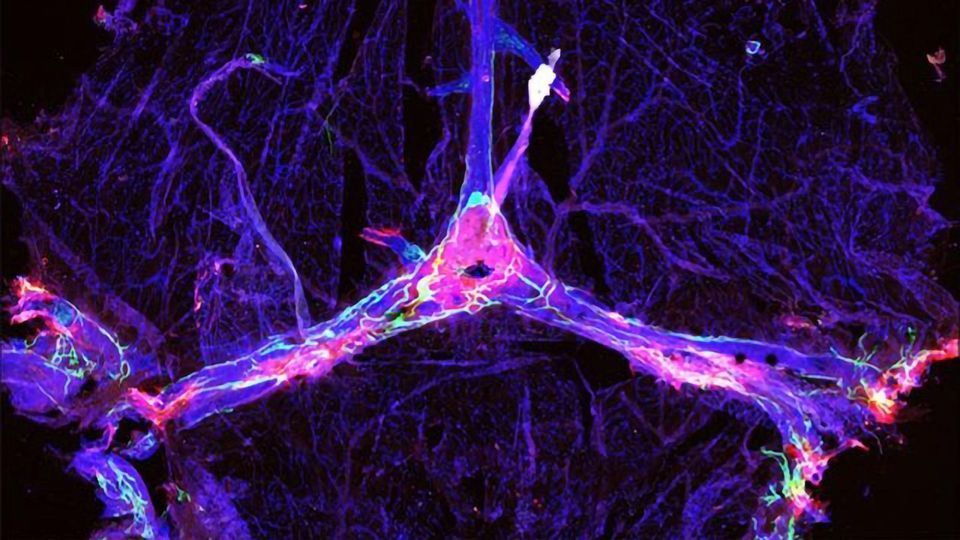 Boosting the Brain's Garbage Disposal Could Assist Alzheimer's ...